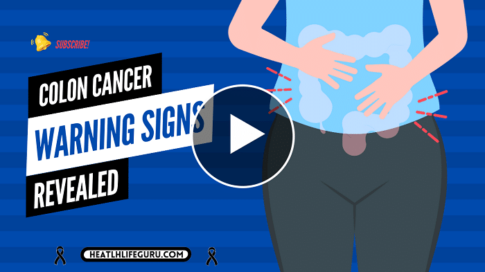 Warning Signs of Colon Cancer You Shouldn’t Ignore - Health Life Guru